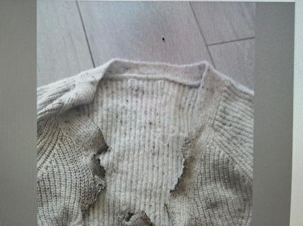 Sufrió quemaduras en el tórax y el cuello por los fuegos artificiales