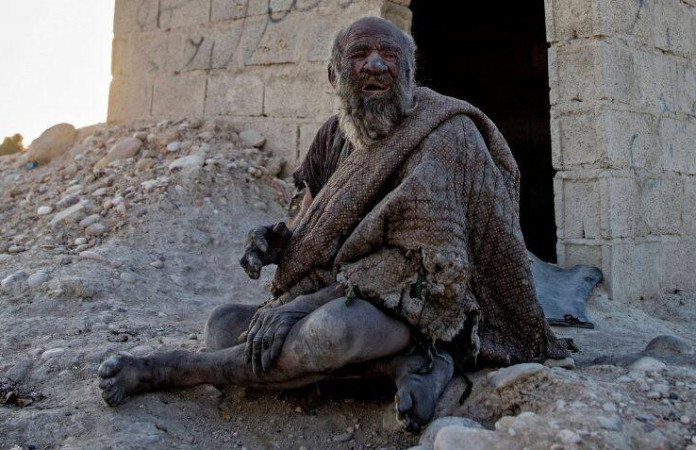 El hombre más sucio se baña por primera vez en 60 años y muere